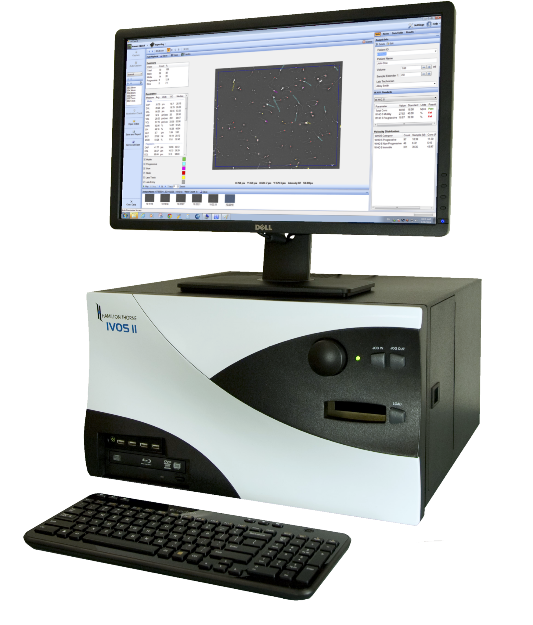 CASA Systems For Sperm Analysis - Hamilton Thorne