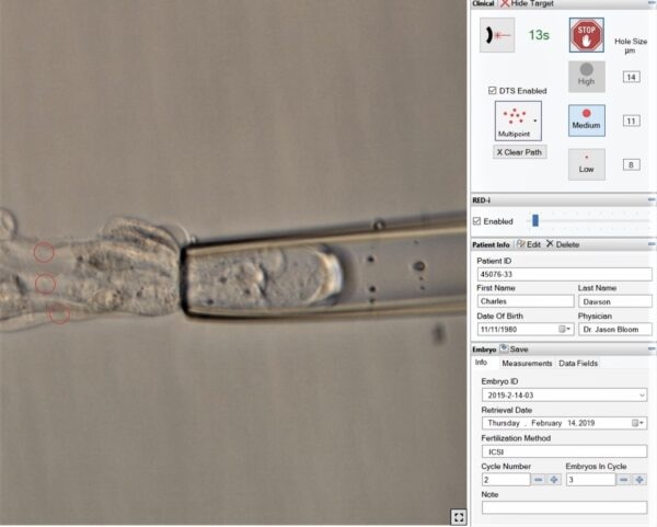 LYKOS® IVF Lasers for ART Procedures