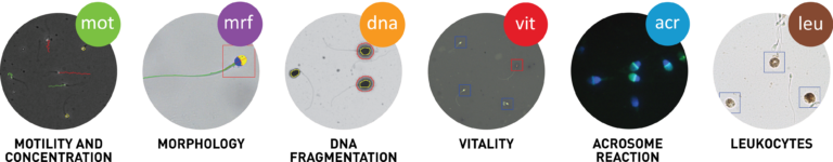 SCA CASA System-Microptic