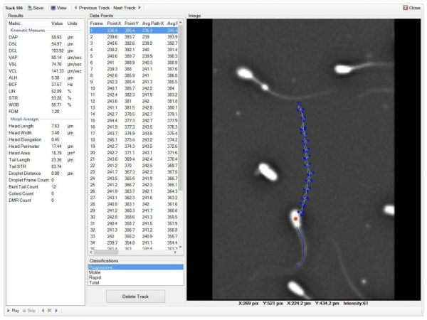 CEROS II Sperm Analysis System - Hamilton Thorne