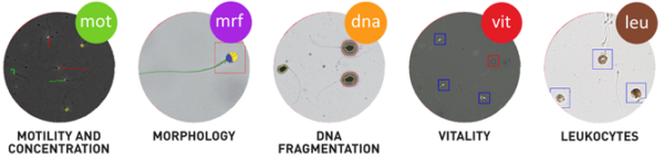 SCA CASA System-Microptic