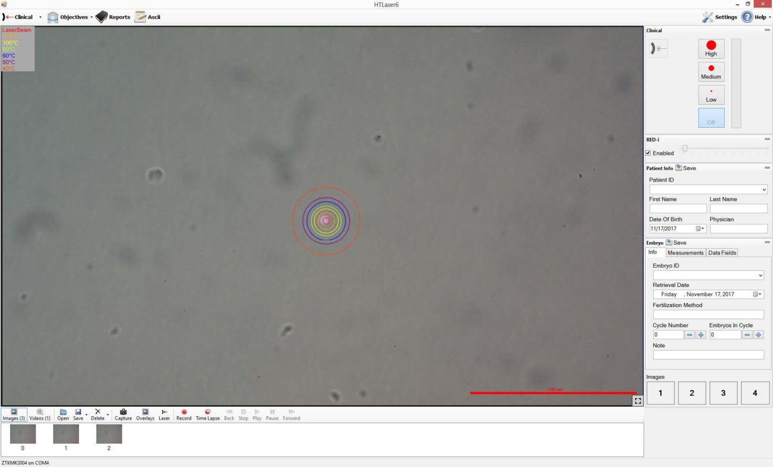 LYKOS® IVF Lasers for ART Procedures