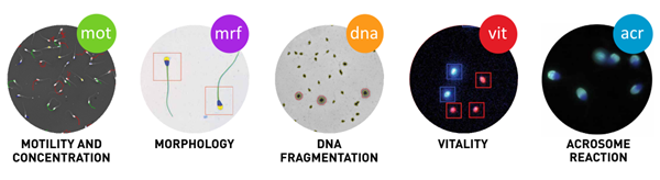 SCA CASA System-Microptic