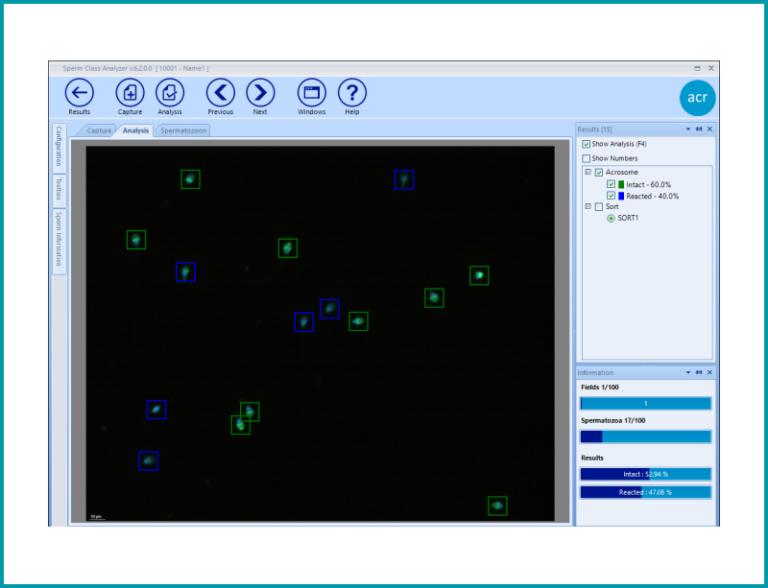 SCA CASA System-Microptic