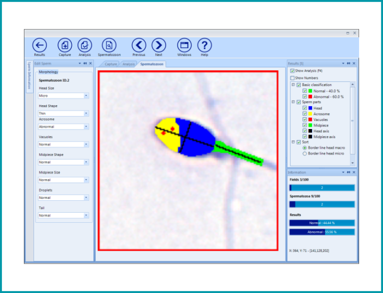 SCA CASA System-Microptic