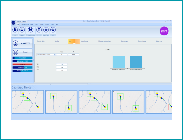 SCA CASA System-Microptic